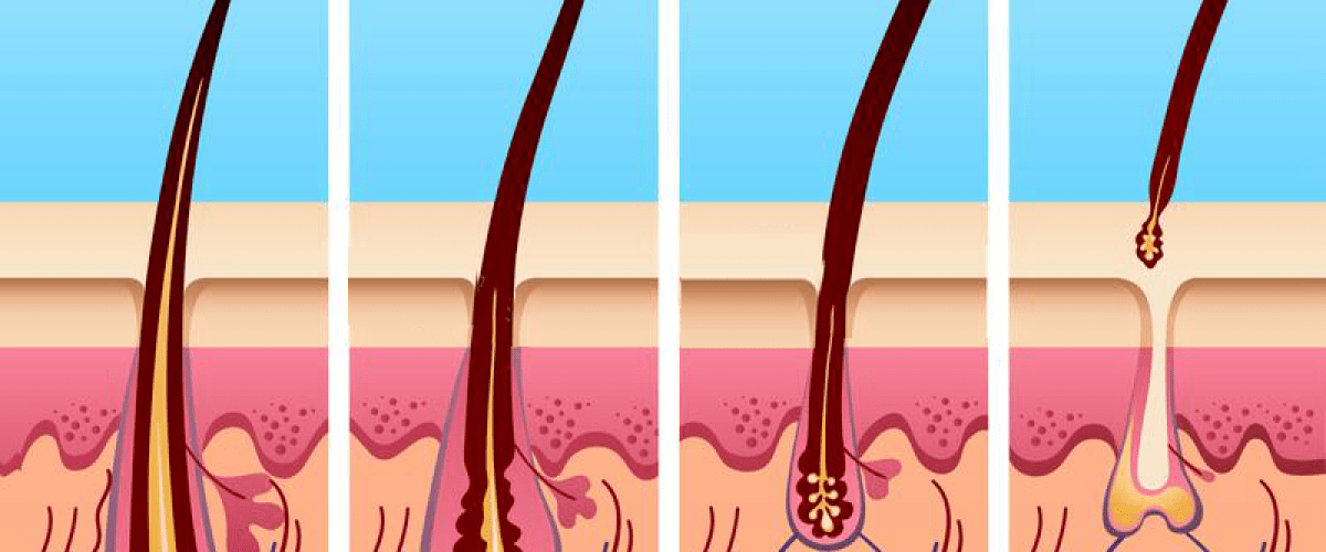 Ongewenste haargroei | Ceulen Klinieken