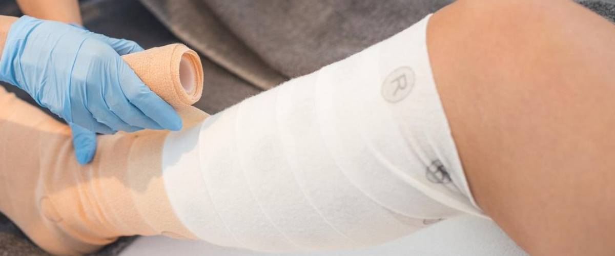 Zwachtelen - Behandeling tegen vochtophoping | Ceulen Klinieken